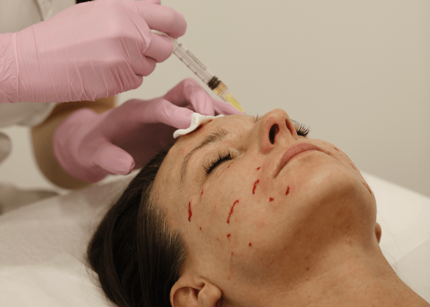 Vampire Lift - Dr Zarqa
